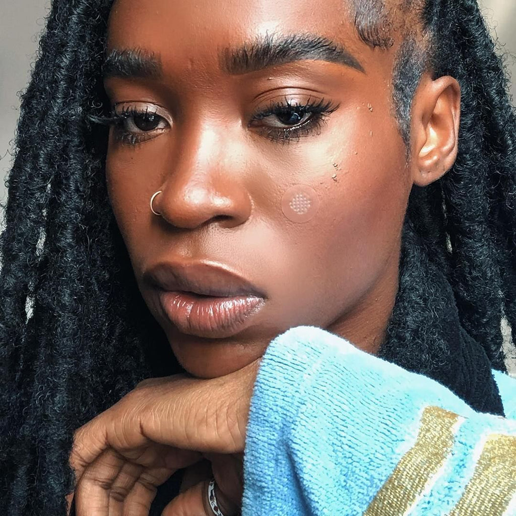 How To Distinguish a Hormonal Zit From a Common Zit? – ZitSticka UK